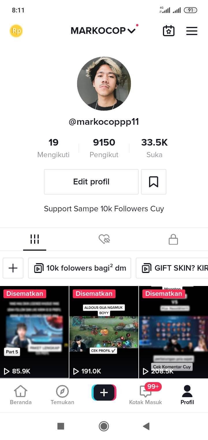 Beli Produk Di Folowers Tiktok Terlengkap Januari 2025 Itemku